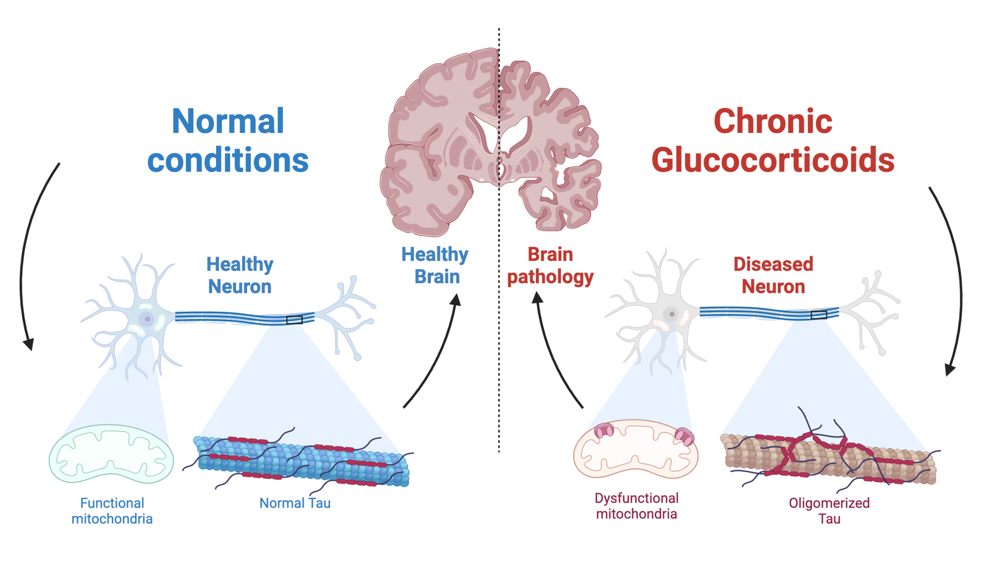 When mitochondria get stressed, our brain suffers: Linking ...